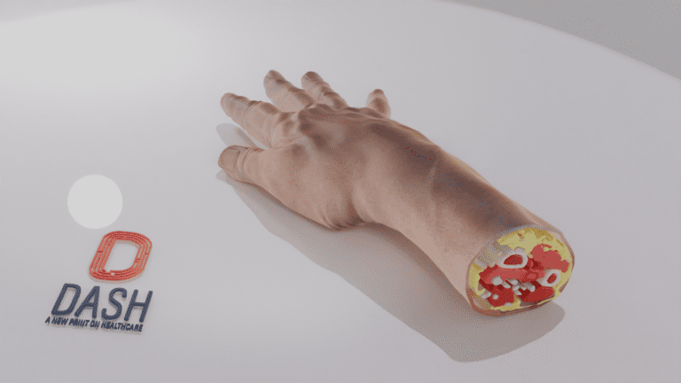Dissectable Hand Anatomical Model - DASH 3D